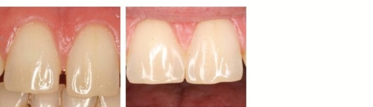 ProxyPal - Directa Dental