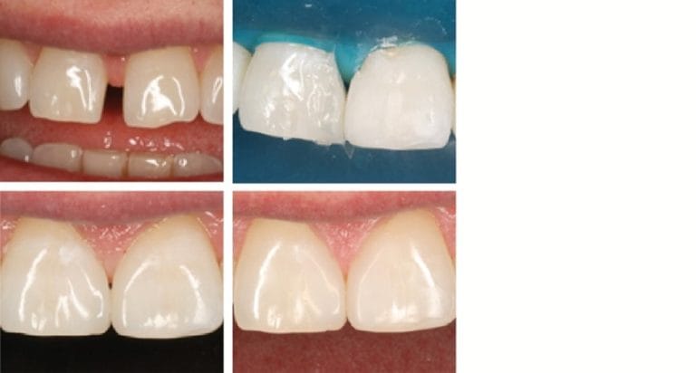 ProxyPal - Directa Dental