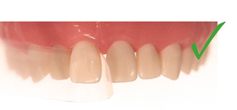 ProxyPal - Directa Dental